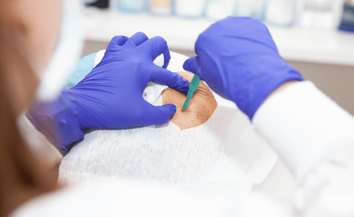 Como a biópsia de mama é realizada: um guia passo a passo | Dra. Sueli ...